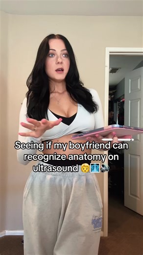 Tyler looking at color Doppler: “why is there fire?” ☠️☠️☠️ #sonographystudent #ultrasound #ultrasoundtech #sonography #sonographyschool @Tyler Grissom