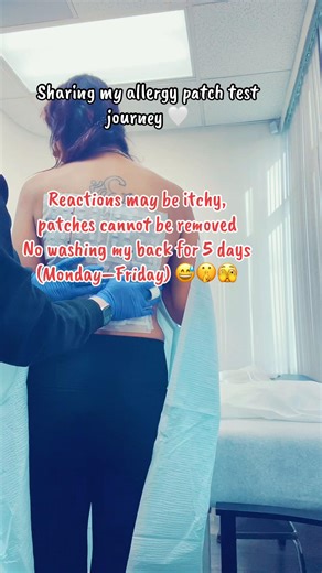 Allergy patch test 🩹 8 patches marked on my back ✍️ Trusting science & Krishna 🙏 Hare Krishna 💛 . #greenparrot🦜 #HealingJourney #TrustTheProcess #HareKrishna #FaithAndHealing @Achal Gopal @Amber Kkhokhar @🩷soni soni🩷