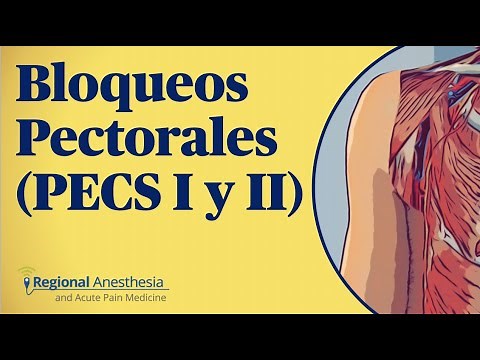 Los Bloqueos Pectorales (PECS I y II)
