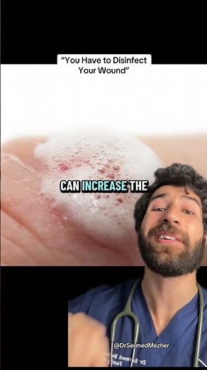 “This Might Sting a Little” #wait