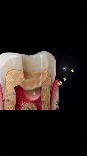 Direct pulp capping | Dr.Dentique-hub