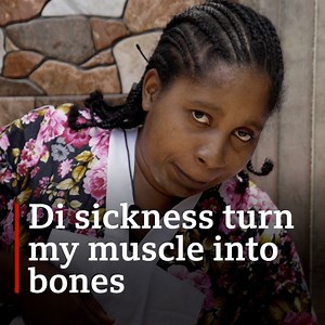 272K views · 4.1K reactions | “I know say na one day, I go become a great pesin, pipo go dey call me Barrister Precious.” Despite her disability, Precious Chiamaka neva abandon her dream to become a lawyer. Fibrodysplasia Ossificans progressiva wey dey turn Precious muscle into bone don deprive am of so many tins, but she say dis condition no go limit am. | BBC News Pidgin | Facebook