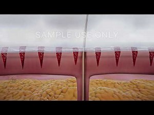 What Is Derma Roller | Microneedling for men can improve skin tone and texture, diminish wrinkles