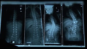 Health Watch: Safer scans for kids