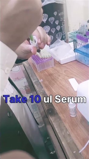 HCV Test Full Procedure #laboratory #trending #test #hematology #serology#chemistry #oncology