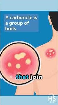 Carbuncle vs. Abscess: 3 Differences #hidradenitissuppurativa #hs #carbuncle #abscess #HSmanagement