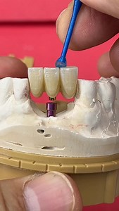 Incredible case!!!! | Luke Kahng