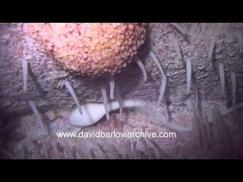 Sperm trapped in Cervical Crypt