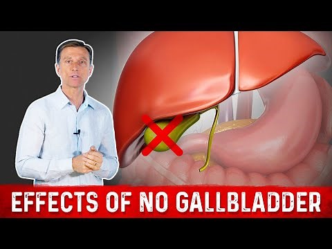 Gallbladder Function: What You MUST Know If You Don't Have a Gallbladder – Dr. Berg