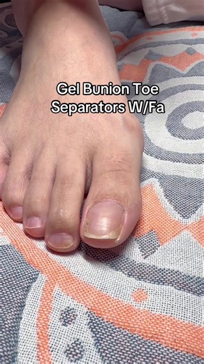 Gel Bunion Toe Separators for Comfort and Relief