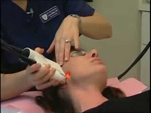 CoolBreeze Laser in Portland, OR | Key Laser Institute