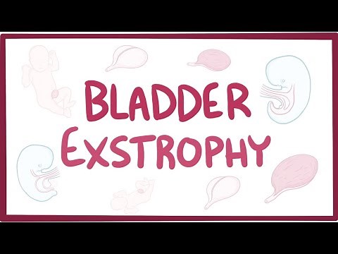 Bladder exstrophy - causes, symptoms, diagnosis, treatment, pathology