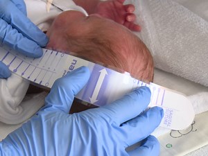 Application of an Amplitude-integrated EEG Monitor Cerebral Function Monitor to Neonates