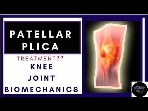 patellar plica syndrome treatment (biomechanics explained) physiotherapy tutorials