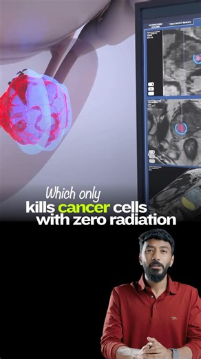 Vaibhav Sisinty on Instagram: "AI Surgery Saves Lives Across Distances Imagine surgeons operating thousands of kilometers away with millimeter precision. India’s Ruby Hall Clinic uses Focal One Robotic HIFU to destroy cancer cells while leaving healthy tissue untouched. This is the future of healthcare. Surgery without distance is real now. Would you let AI operate on you? Follow for more breakthroughs. . . . . . . . [cancer treatment, AI surgery, robotic surgery, Focal One, AI healthcare, remot