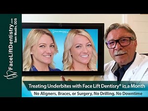 Underbite Correction without Surgery, Braces, or Clear Aligners, in a Month.