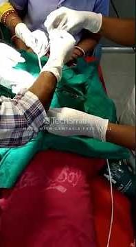 what is sebaceous cyst?