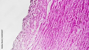 Pattern of human large artery taken for experiment and magnified under microscope 200x against bright field background. Macro isolated view of blood vessel taking it away from heart to other body part