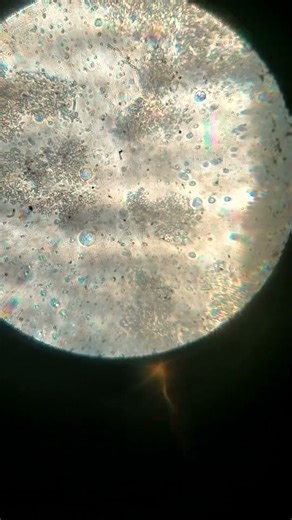 curd through microscope