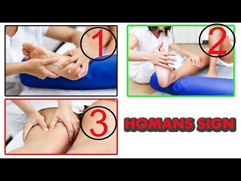 Homans Sign : homans sign symptoms - Positive and nagative homans sign