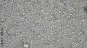 Sperm under the microscope. Looking a semen swimming. Healthy fertile man high sperm count