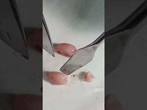 Dissection of mouse hippocampus | Mouse hippocampus dissection | UGM