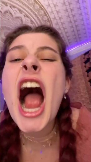 Reasons why you Should be Wearing your Retainers