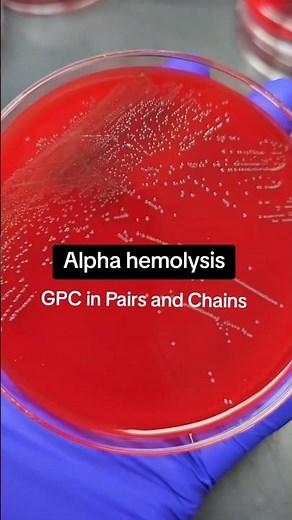 Enterococcus faecium