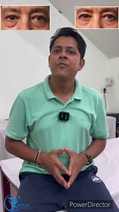 Eye Bag relief Exercise. Puffy Eye Solution. #eyebag #puffyeyes #eyebagtreatment #exerciseforhealthyeyes | Drsunil Baghel Physio