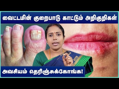 நகம், முடி, தோல் பிரச்சனை? காரணம் இதுதான்!" (Nails, Hair, Skin problems? This is the reason!)