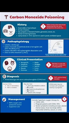 Carbon Monoxide Poisoning | MRCP UK