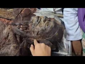 Dissection of head and neck (part 1)