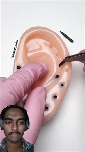 Most Satisfying Ear Blackhead Removal 2026! 👂✨#blackheadremoval #skincare
