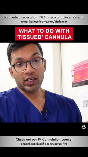 Troubleshooting Tissued Cannulas: Techniques and Tips