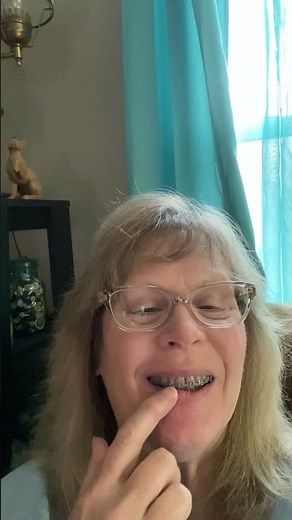 Braces update, age 60, orthodontist visit yesterday