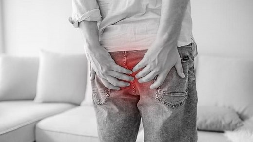 Le kyste pilonidal : douloureux mais bénin