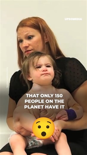 10K views · 107 reactions | Madison was diagnosed with a nearly unique syndrome in the world. Her story inspires everyone who believes in second chances. | Vitamin | Facebook