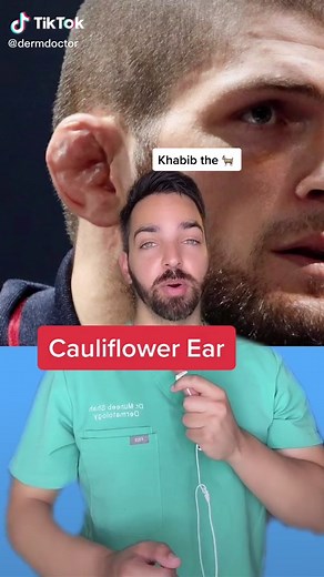 Understanding Cauliflower Ear: Causes, Symptoms, and Treatment