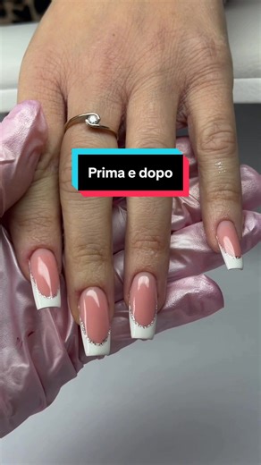Ricostruzione unghie a Rimini - guarda la trasformazione #nails #unghie #primaedopo #unghierimini #unghiegel dove fare unghie gel a Rimini, miglior nail artist a Rimini ricostruzione unghie in gel Rimini refill unghie gel Rimini semipermanente resistente Rimini manicure curativa Rimini unghie baby boomer Rimini unghie French Rimini unghie corte naturali Rimini nail art dettagliata Rimini unghie effetto vetro Rimini unghie effetto cat eye Rimini unghie nude eleganti Rimini nail art minimal Rimini
