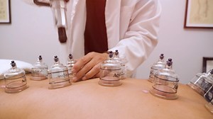 Have you ever tried #CUPPING? Cupping improves overall health by removing energy blockages. Our acupuncturist, @lee.acupuncture, identifies the barriers that prevent a healthy energy flow called #qi. For #athletes, cupping is super beneficial as it increases blood flow to particular muscle regions and helps reduce pain. | Get Adjusted Chiropractic P.C.