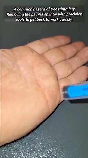 Splinter first aid: quick removal after a trimming job.