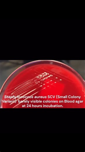 🔹 The isolate (Staphylococcus aureus) is showing characteristics of a Small Colony Variant (SCV). SCVs are slow-growing subpopulations that form tiny, non-pigmented, non-hemolytic colonies with altered metabolism and specific auxotrophies (commonly for hemin, menadione, or thymidine). This explains: 🔹 Barely visible colonies after overnight incubation 🔹 Growth only visible after prolonged incubation (4 days) 🔹 Better growth when Mueller-Hinton agar is supplemented with blood, which provides 