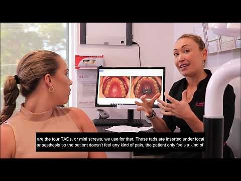 The MSE Expander - Dr. Derek Mahony & Dr. Isabel Drewling part 1