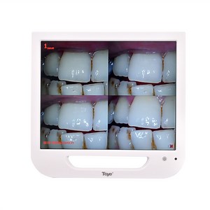 [Hot Item] Medical Dental Equipment WiFi Type Intra Oral Camera