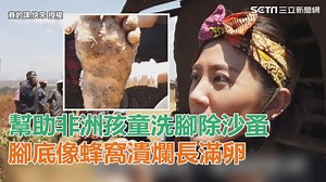 【經典回顧】幫助非洲孩童洗腳除沙蚤　腳底像蜂窩潰爛長滿卵 #路摸思編：無法想像世界上有那麼辛苦可憐的孩子 ▌影片授權：賽的課,快來 ▌非典牧師Sai ▌YT頻道→https://reurl.cc/mdpjdV | 三立iNEWS | Facebook
