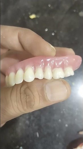 Upper Complete Denture With suction 🪠🪠
