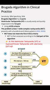 37K views · 120 reactions | 變 Brugada Algorithm in Clinical Practice...