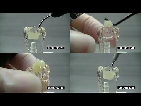 ESTELITE BULK FILL FLOW in comparison | Tokuyama Dental