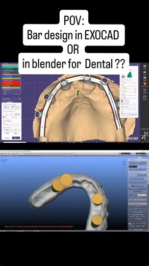 dt mohmmad on Instagram‎: "Blender for Dental 🦷 هو من البرامج التي ظهرت حديثا وتميز البرنامج بقدرته على تصميم تعويضات الأسنان بطريقة فريدة وله تطبيقات عدة أشهرها تطبيق صنع البار i-BAR علق بنقطة ليصلك تفاصيل البرنامج او شراؤه 🙏 . #exocad #reels #instagram #explore #dental #teeth #dentaltechnics"‎