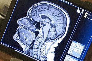 U of T researchers look for clues in big data to enlist stem cells for brain repair